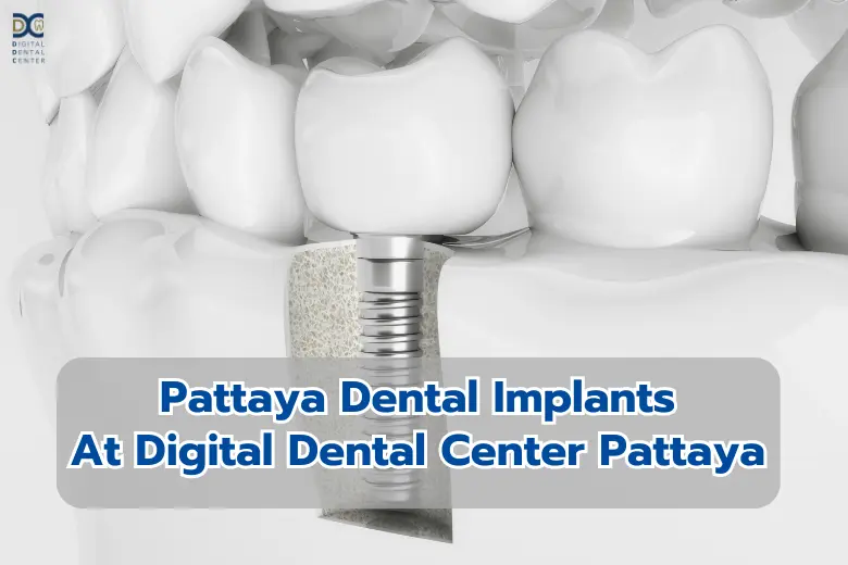 Dental Clinic & Implant Dentistry in Pattaya, Thailand | DDC
